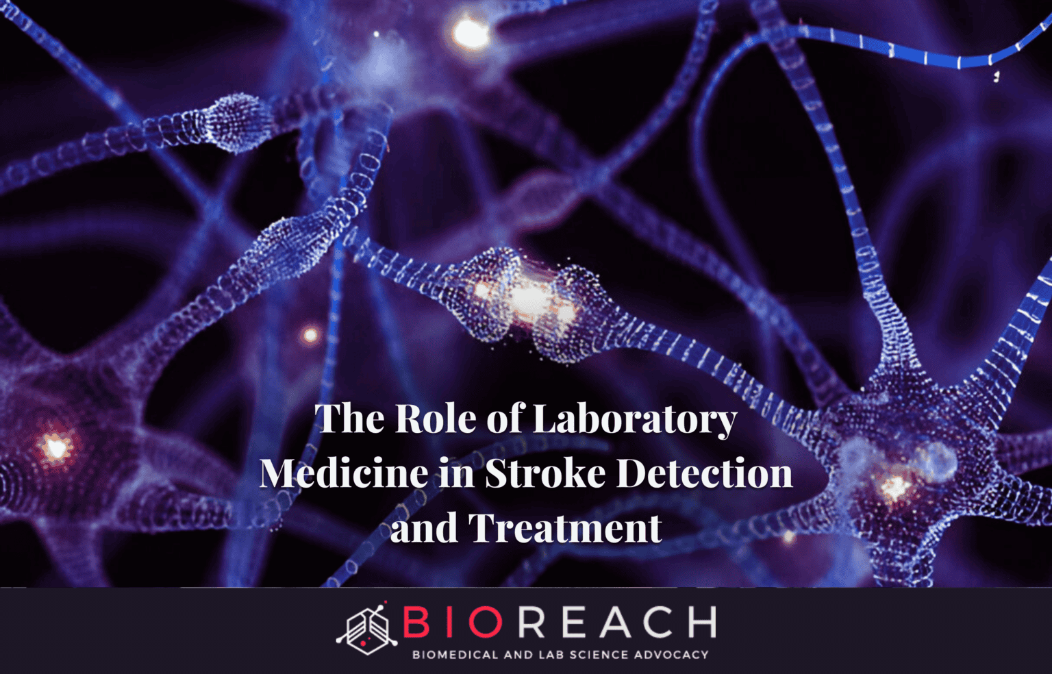 The Critical Role of Laboratory Medicine in Stroke Detection and ...