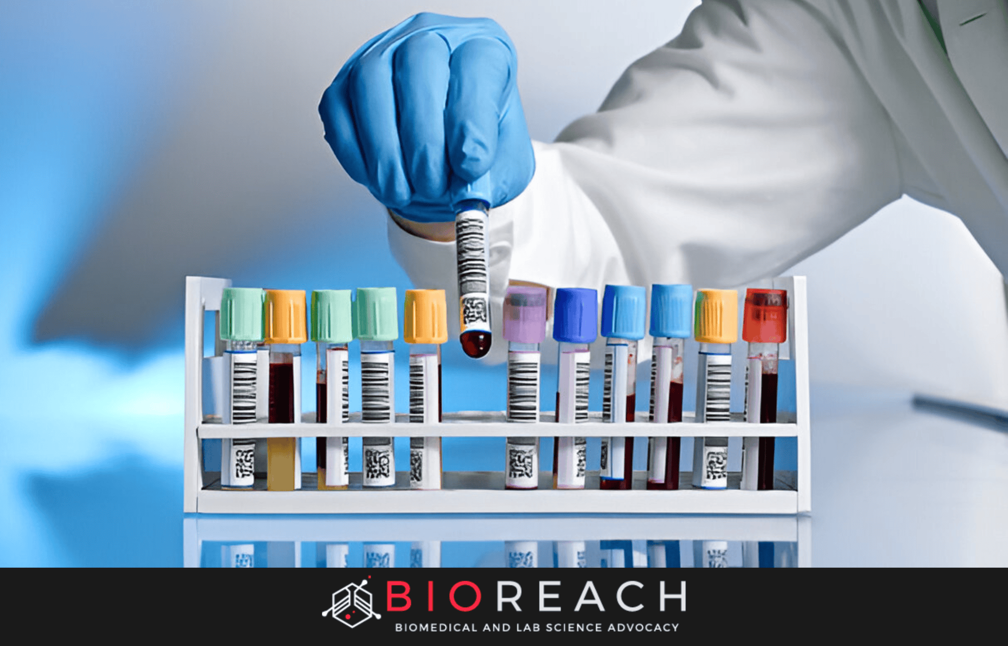 Medical Laboratory Science: A Spectrum of Career Paths - Bio-Reach